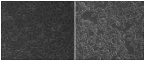 Porcine Pseudorabies Virus Double Gene Deletion Strain Eureka Patsnap