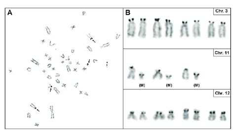 Visualization Of Nucleolar Organizer Sites Nors By Silver Staining Download Scientific