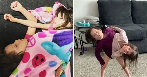 mom of conjoined twins explains importance of acceptance scoop upworthy