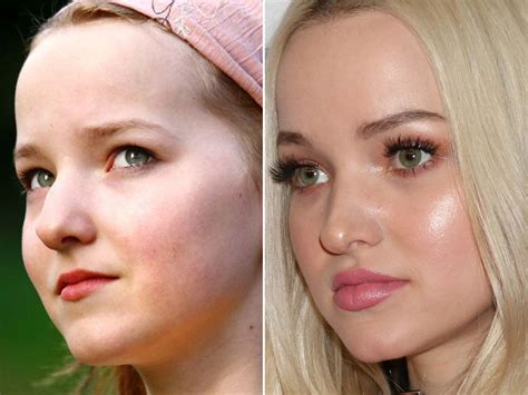 Dove Cameron Before And After Artofit