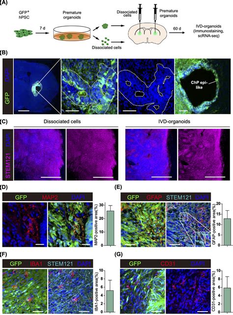 In Vivo Development Of Human Brain Organoids In Mouse Brain A Download Scientific Diagram