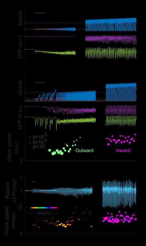 Subtypes Of Seizure Onset Pattern Can Arise From Different Download Scientific Diagram