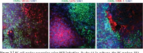 Figure 7 From Derivation Of Neural Crest Cells From Human Pluripotent Stem Cells Semantic Scholar