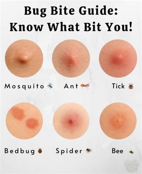 Now You Can See What Bit You 🐍🐝🐜🪲🦗🕷🪳🦂 In 2025 Ant Bites Insect Bites Bug Bites