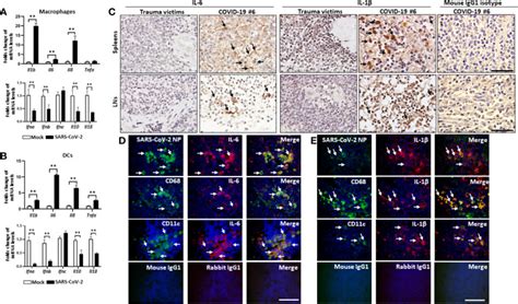 Sars Cov 2 Induces Lymphocytopenia By Promoting Inflammation And
