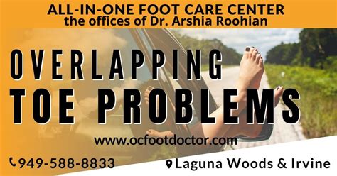 Overlapping Toe Problems
