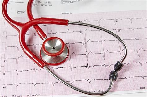 Understanding AFib What You Need To Know LMH Health Lawrence KS