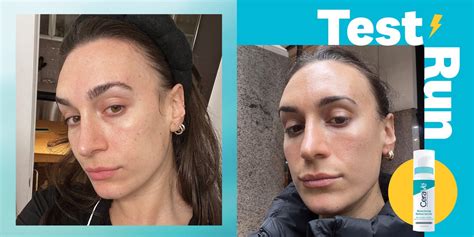 My Skin Did A Major 180 In These Before And After Retinol Photos