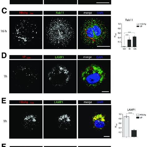 Differential Localization Of HBV And Recombinant HBsAg In THP
