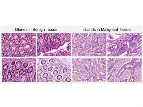 Histological Pattern Pptx Is Histology Patterns Ppt