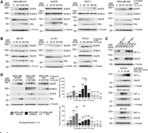 Figure 2 From Disseminated Tumor Cells Persist In The Bone Marrow Of