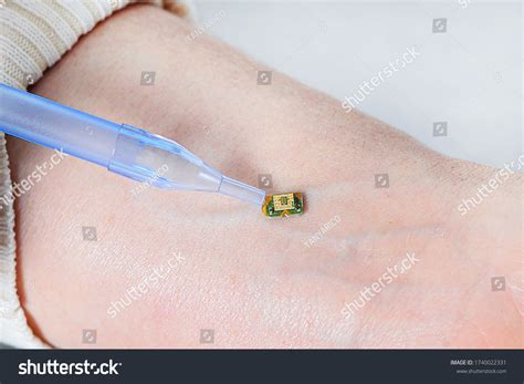 3 Imágenes De Restriction Modification System Imágenes Fotos Y