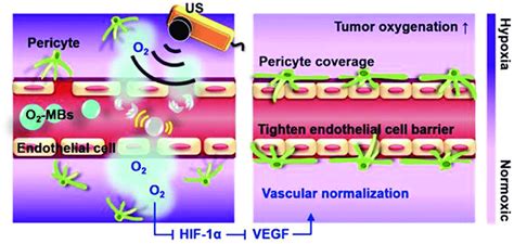 The Concept Of Tumour Vascular Normalization Induced By Us With O 2