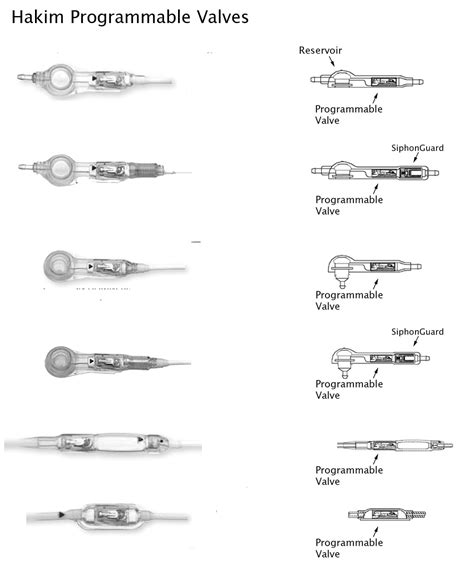 Codman Programmable Shunt Brain