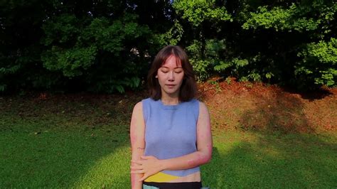 Takeda On Linkedin Psoriaticdisease Worldpsoriasisday