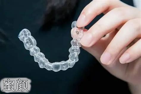 隐适美和钢牙套哪个好？ 蜜颜优惠