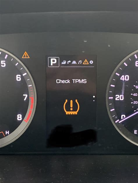 tpms issue 2015 sonata r sonata