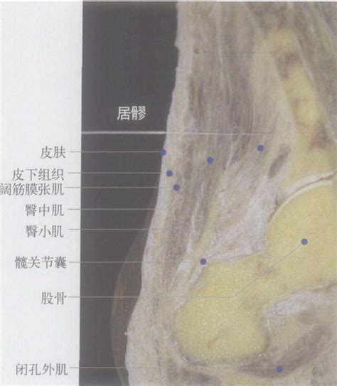 图12 27居髎穴斜切面 中医学 医学