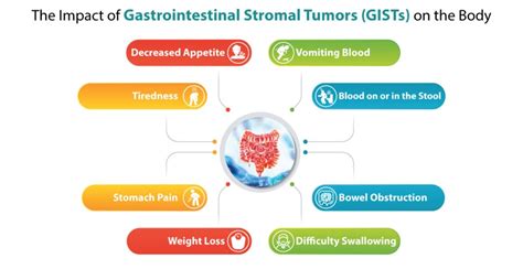 Gastrointestinal Stromal Tumor Gist Diagnosis And Early Detection
