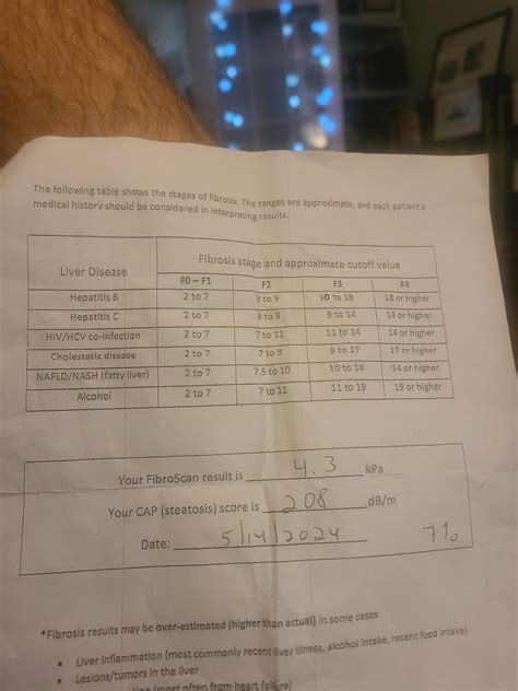 Fibroscan Results R Nafld