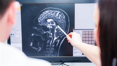 How To Prevent Brain Tumor