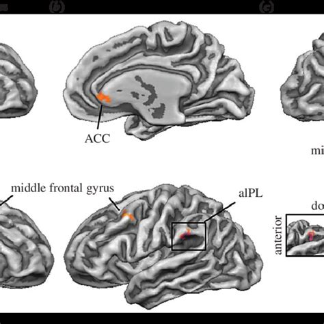 Pdf The Role Of The Basolateral Amygdala In The Perception Of Faces