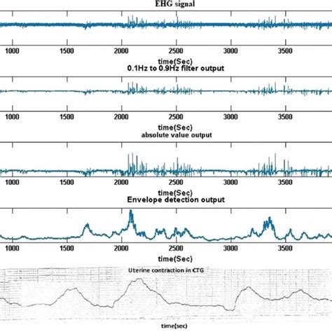 Power Spectrum Of Single Uterine Contraction Portion In Ehg Signal A