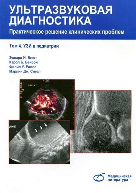 Ультразвуковая диагностика Практическое решение клинических проблем