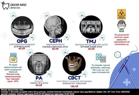 Ochir 👩🏻‍⚕️Төв салбар бүх төрлийн рентген оношлогоо хийж байна Үүнд ️Дэлгэмэл зураг 🩵Гавлийн