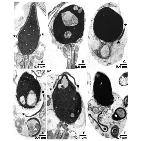 Electron Microscopy In Patient Arg13 A Normal Sperm Head From A