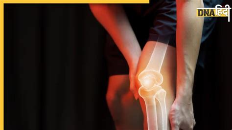 Calcium Deficiency Symptoms Latest News And Updates In Hindi Calcium