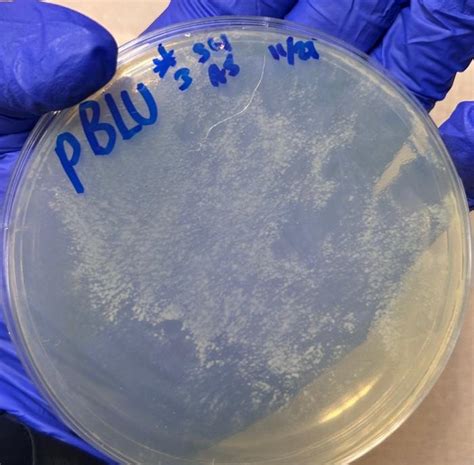 Solved 2 What Are The 2 Major Features Of Plasmid 05 3