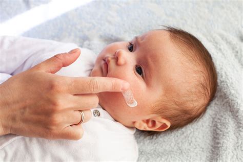 La dermatite atopica cos è e come si cura I consigli della pediatra