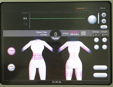 Buy 2019 Factory Price Mini Hifuhigh Intensity Focused Ultrasound
