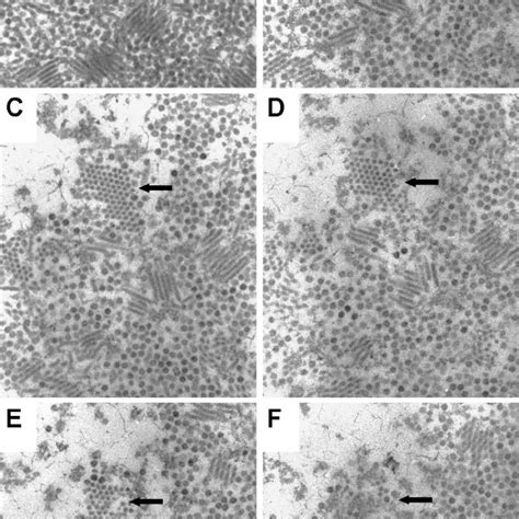 Transmission Electron Micrographs Of Continuous Serial Gray Colored