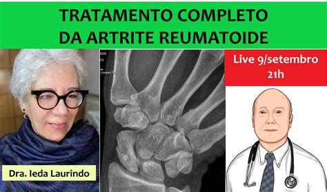 Os tratamentos para artrite reumatoide que funcionam segurança COVID e vacinas na artrite