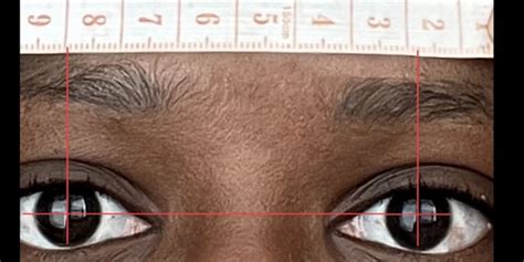 Cant Seem To Get An Accurate Pd Measure Help Rmyopia