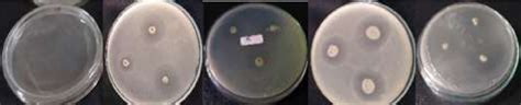 Inhibition Ability Of Isolated Bacteria Against R Solanacearum In