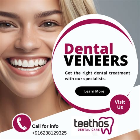 Unlocking Your Smile Exploring Dental Veneers Cost In Kerala