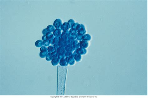 Opportunistic Mycoses Flashcards Quizlet