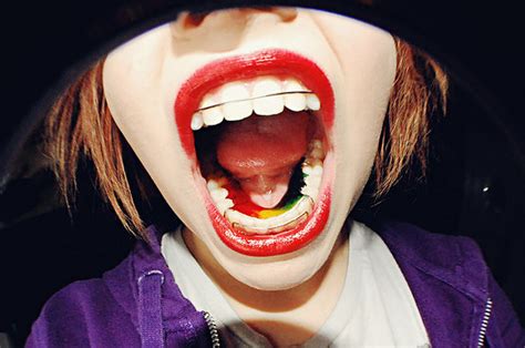 15 Horrifying Things That Happen When You Get A Retainer