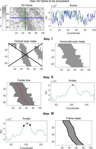 Main Steps Of The Algorithm For Diameter Estimation The Top Panel