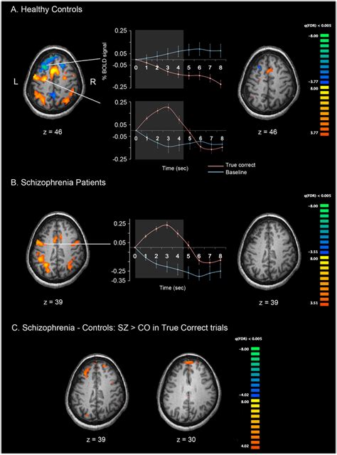 Cortical Activation Patterns During Verbal Wm Maintenance For The Two Download Scientific