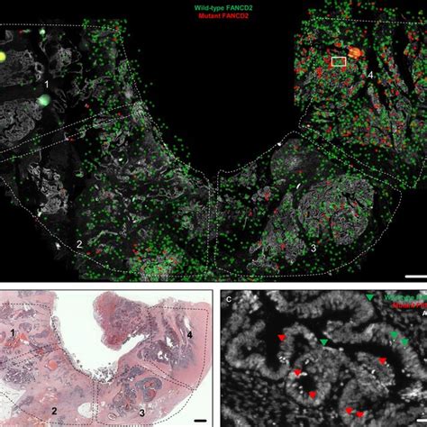 In Situ Mutation Detection Of Kat6a Wild Type And Mutant Transcripts In