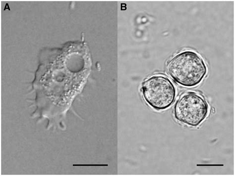 Acanthamoeba Cyst
