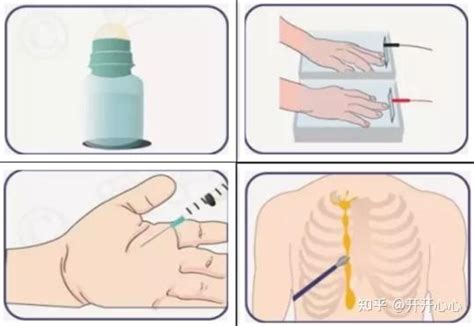 一年四季都出汗，手脚多汗最为严重，这是怎么了？ 知乎