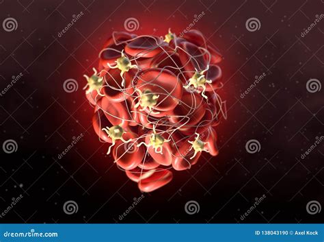 Thrombus En Circulation Sanguine Caillot Sanguin Avec Les Plaquettes Activées Et Fibrine
