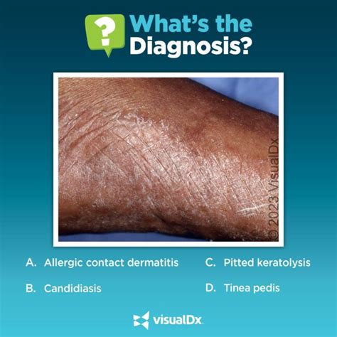 A 38 Year Old Man Has A Pruritic Rash That Developed In A Week Lets