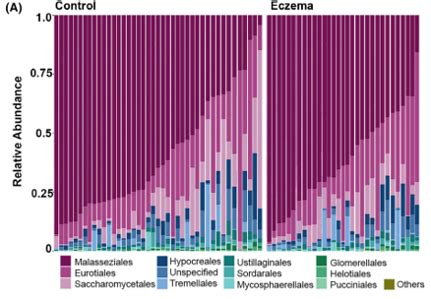 폭포 쏟아지는 듯한 누적 막대 그래프를 만드려면 어떤식으로 해야할까요 오빠두엑셀