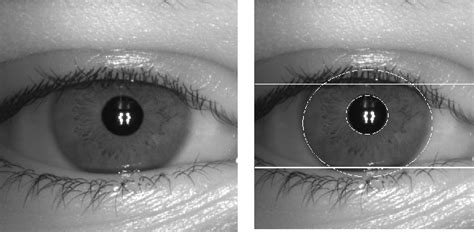 figure 1 from svm based gender classification using iris images